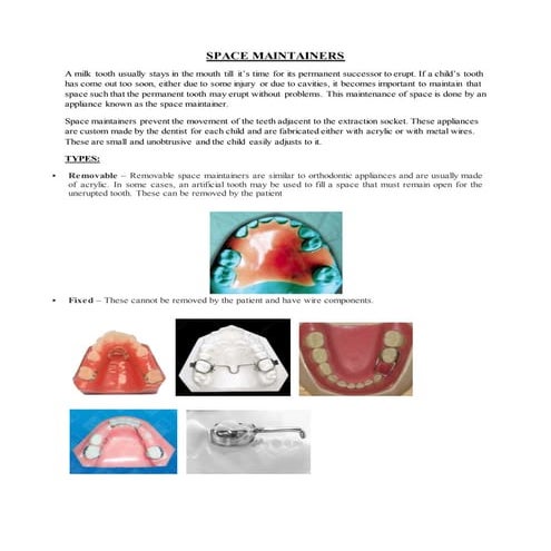 Space maintainer blog | DOCX