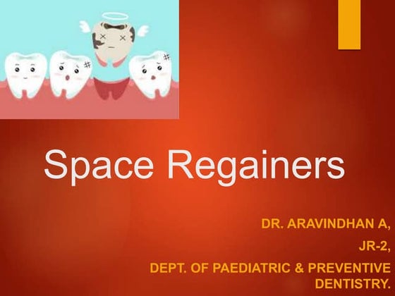 SPACE REGAINERS IN TOOTH LOSS (PEDIATRIC DENTISTRY) | PPT