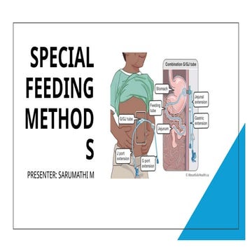 Special Feeding Methods: Enteral and Parenteral Nutrition | PPTX