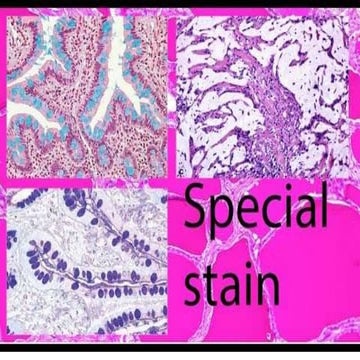 SPECIAL STAINS USED IN DIAGNOSING LIVER PATHOLOGY | PPTX