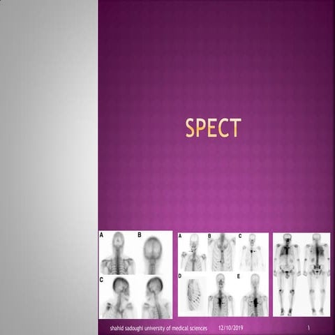 Spect artifact | PDF