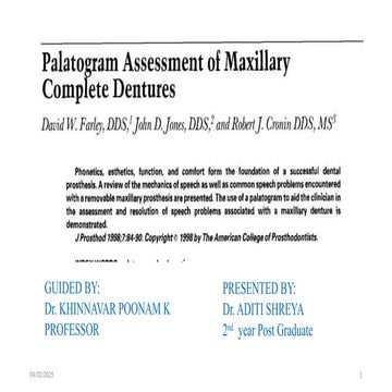Journal club on palatogram for speech aid | PPT