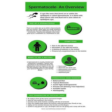 Spermatocele an overview | PDF