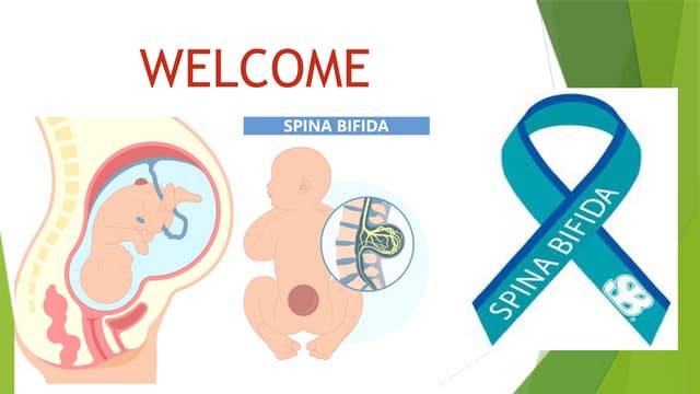 Spina bifida Neurological disorder | PPTX