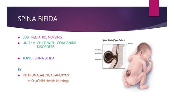 Spina bifida - Child Health Nursing | PPT