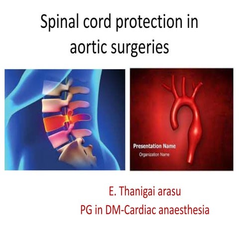 Spinal cord protection in aortic surgeries | PPTX
