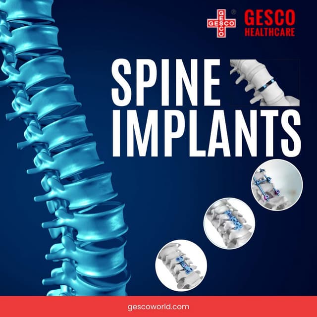 spinal implants | PPTX