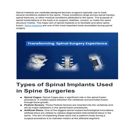 Spinal Implants- Transforming the Spinal Surgery Experience.pptx