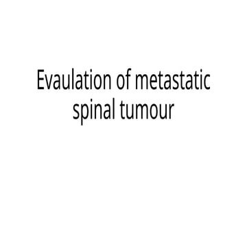 spinal metastasis.pptx spinal metastasis | PPTX