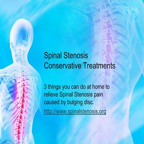 Spinal Stenosis Conservative Treatments | PPTX