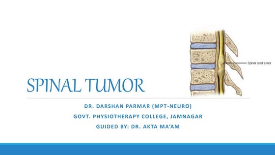 Spinal cord tumors | PPT