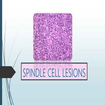 Spindle cell lesions of head & neck | PPTX