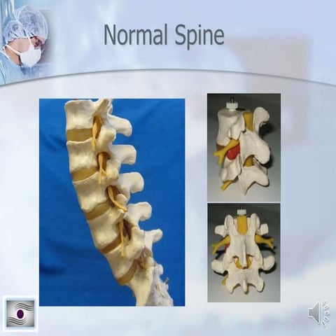Normal Spine/Normal Disc/Painful Disc/Herniated disc | PPTX | Death ...