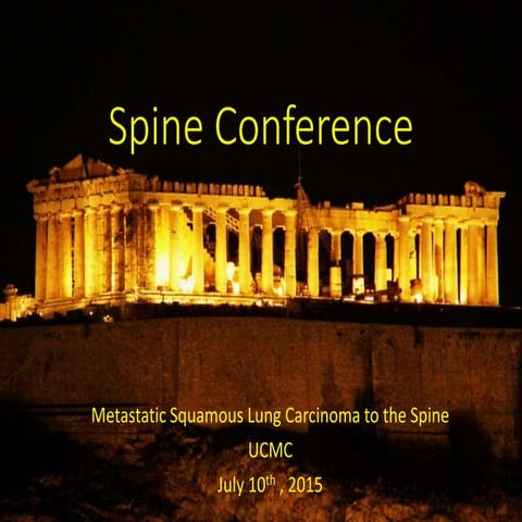 “Spinal Tumors: Diagnosis, Management, and Physiotherapy Rehabilitation ...