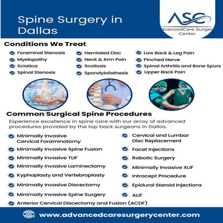 Best Spine Surgery in Dallas, Texas United States | PDF