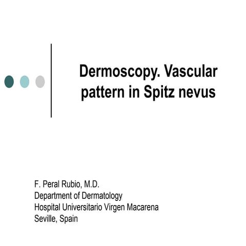 Spitz nevus | PPT