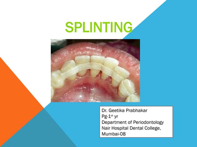 Splinting procedure and steps in dentistry. | PPT