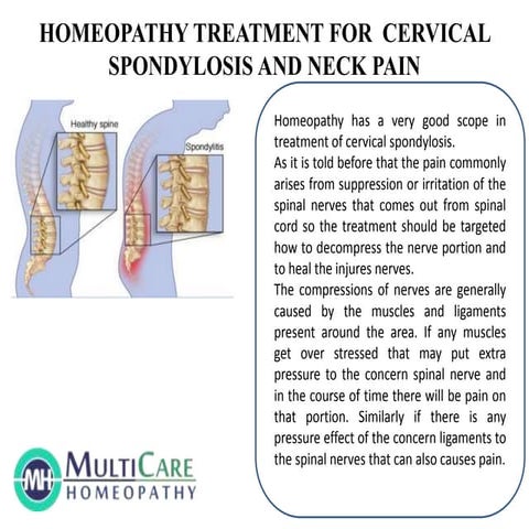6 Best Homeopathic Medicines for Cervical spondylitis and Neck Pain. | PPT