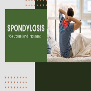 Spondylosis Type, Causes and Treatment.pptx | Physical Therapy | Wellness