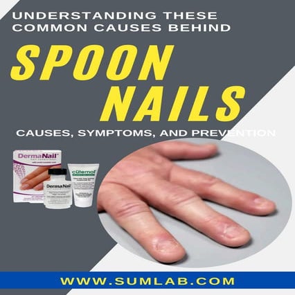What are spoon nails and how can they affect your overall nail health ...