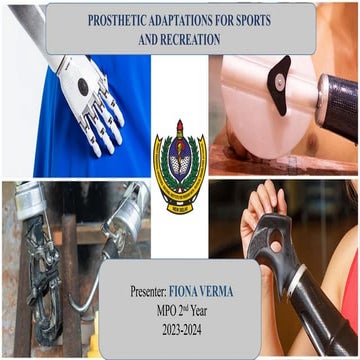 PROSTHETIC MANAGEMENT OF TRANSTIBIAL AMPUTATION AND ITS BIOMECHANICS | PDF