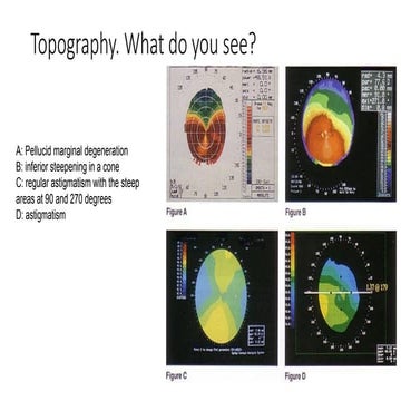 Spot Diagnosis - Look at the pictures-What do you See - Topography.pptx