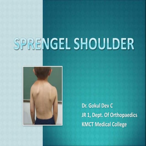 SPRENGEL SHOULDER.pptx