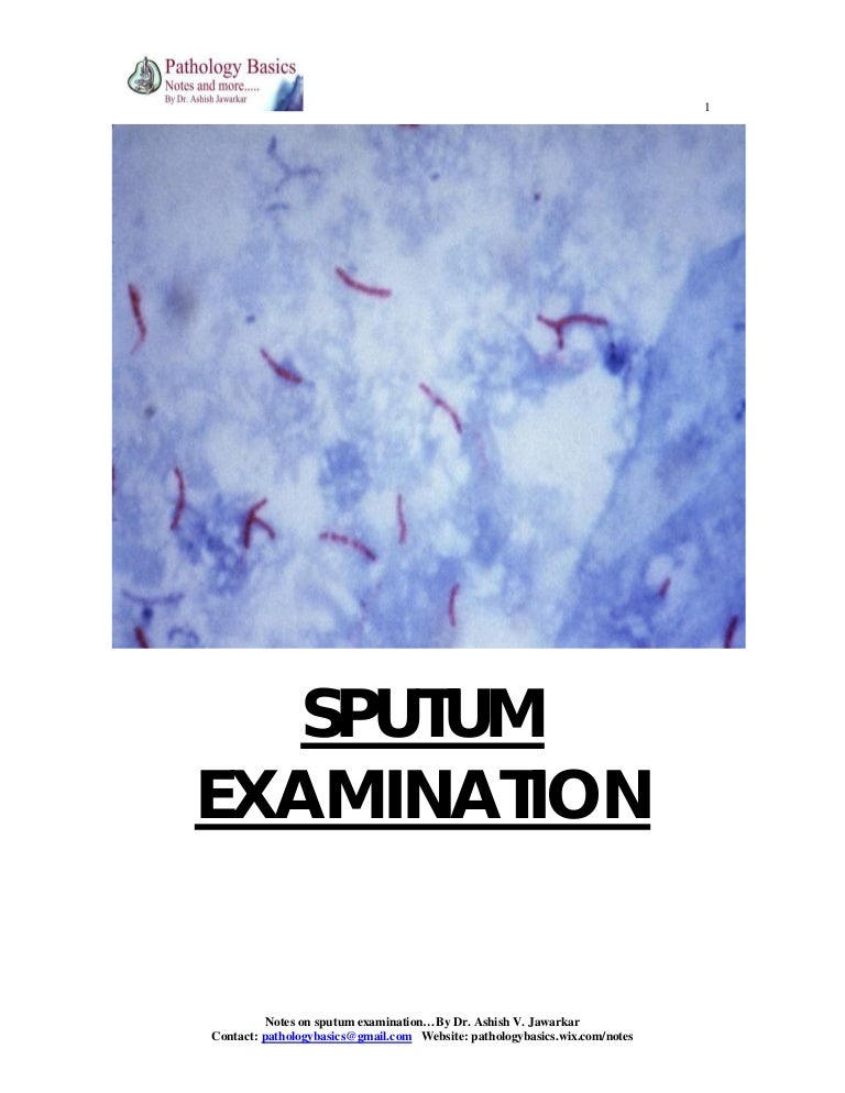Sputum 131228082739-phpapp01