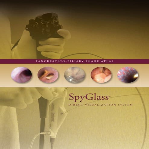 Spyglass atlas | PDF
