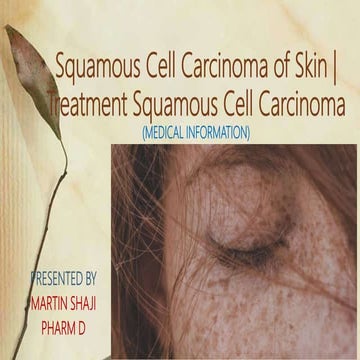Squamous cell carcinoma of skin | management -all medical aspects. | PPTX