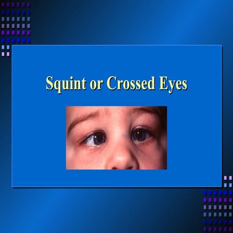 Squint-Datta Gulnar | PPT | Eye and Vision Conditions | Diseases and ...
