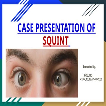 Squint eye case presentation opthalmology | PPTX