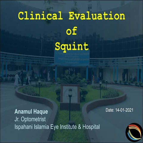 squint assessment optom Anamul haq | PPTX