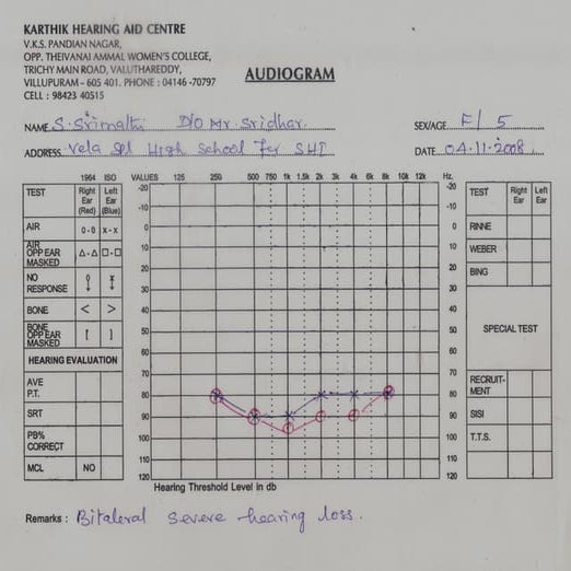 Audiogram 7 children | PDF