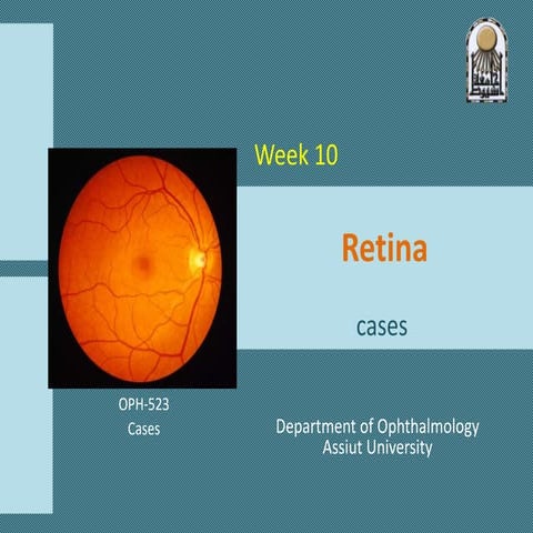 Common retinal diseases, case discussion.pptx | Eye and Vision Conditions | Diseases and Conditions