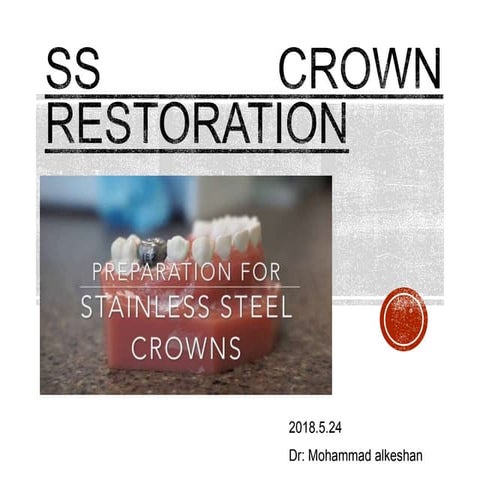 SS crown restoration | PPT