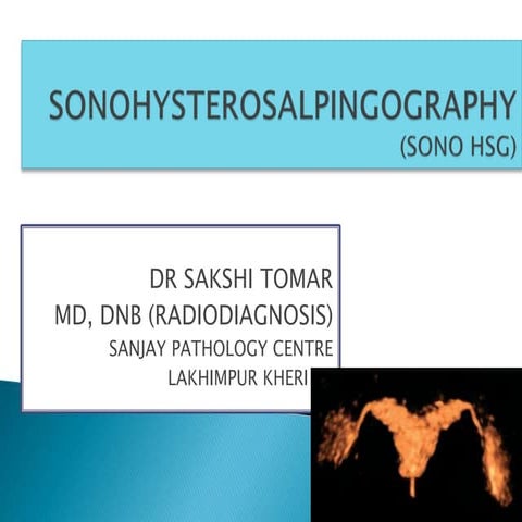 SONOSALPINGOGRAPHY STEPS BY LATE DR SAKSHI | PPTX