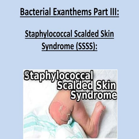Staphylococcal Scalded Skin Syndrome Histology