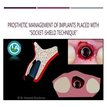 Prosthetic management of implant placed with socket-shield technique ...