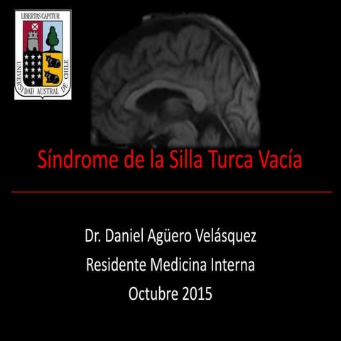 Anatomía De La Silla Turca Cirugía Transesfenoidal | Cirujano