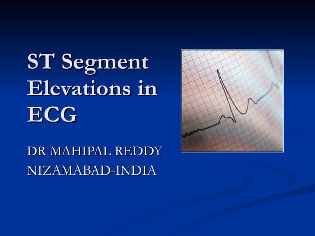 ST Segment Elevations in ECG | PPT