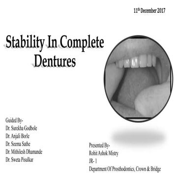 Retention stability support in complete dentures | PPT