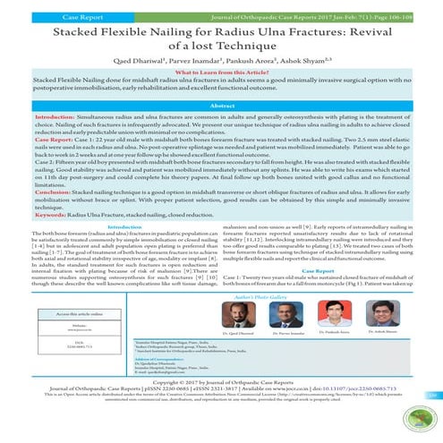 Stacked Flexible Nailing for Radius Ulna Fractures: Revival of a lost ...