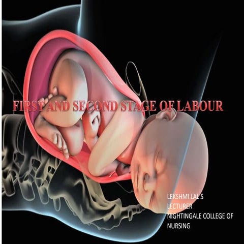 Labor room setting | PPTX