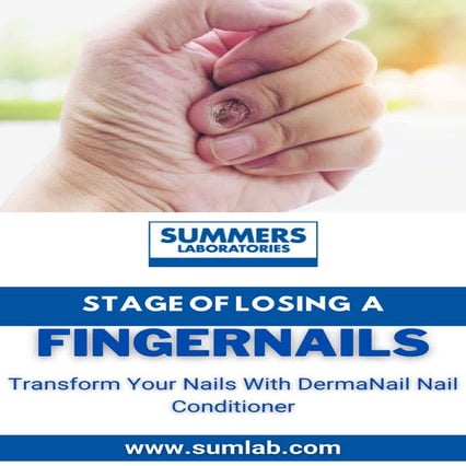 What are the common reasons for losing a fingernail? | PDF