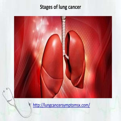 Final stages of life with lung cancer
