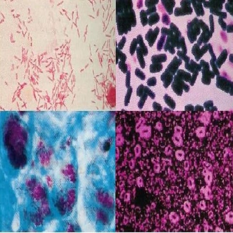 ROMANOWSKY STAINS-1.pptx