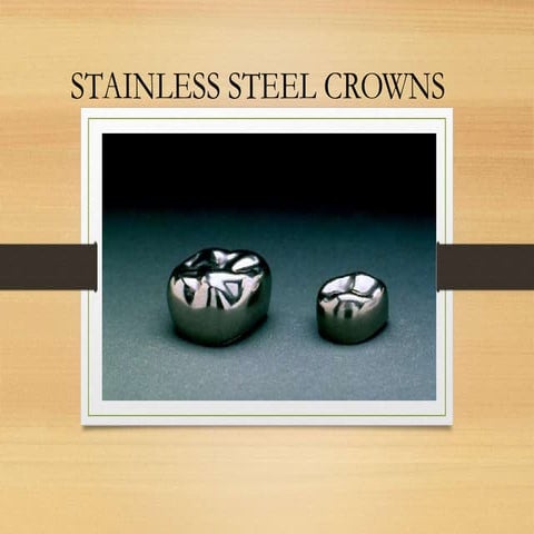 Stainless steel crowns | PPT