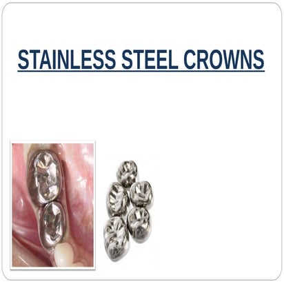 stainless steel crownsstainless steel crownsstainless steel crowns | PPTX