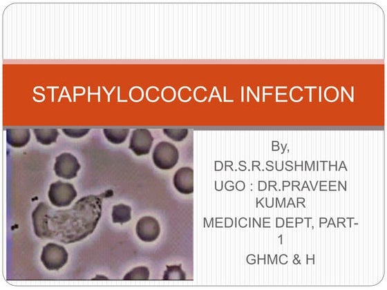 Pharmacology of Anti - fungal Drugs .pptx | Lung and Respiratory Health ...